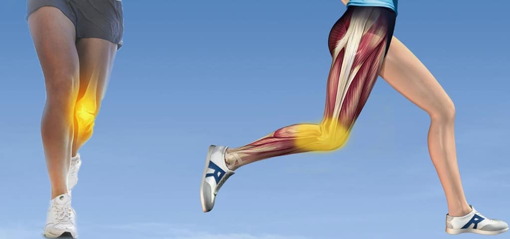 Enthesopathy: Causes, Symptoms, and Treatment Options